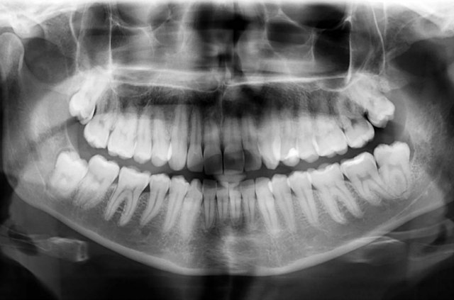 The Importance of Technology Transfer | Better World